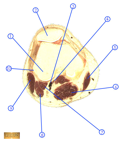 Lower limb cross sections