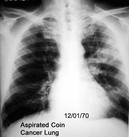 Try to identify the following