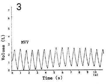Maximal voluntary ventilation (MVV)
