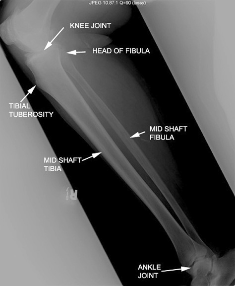Identify the parts seen. Click the image for labeling.