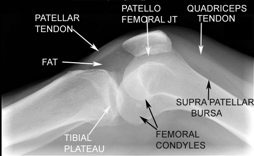 identify the structures seen click the image for labeling