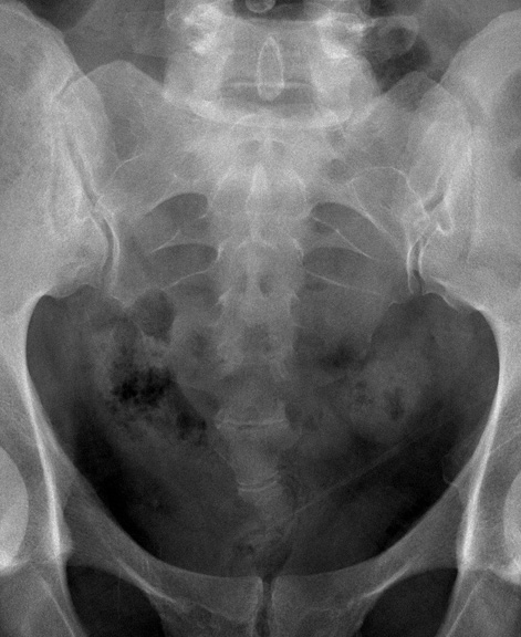 Identify parts of the sacrum. Click the image for labeling.