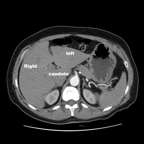 The human esophagus is about 10 in