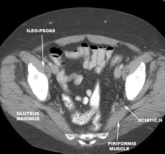 Course of Esophagus
