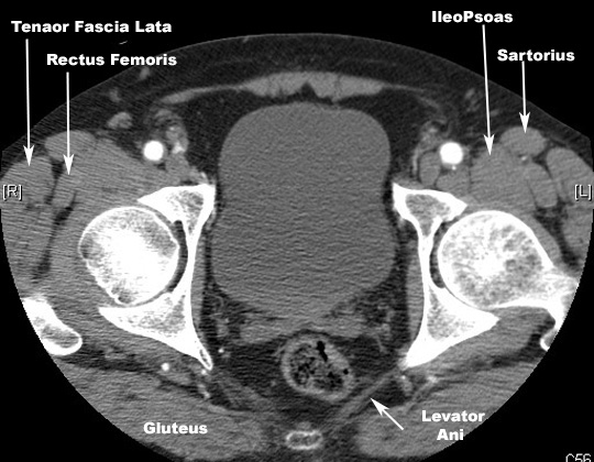 Course of Esophagus