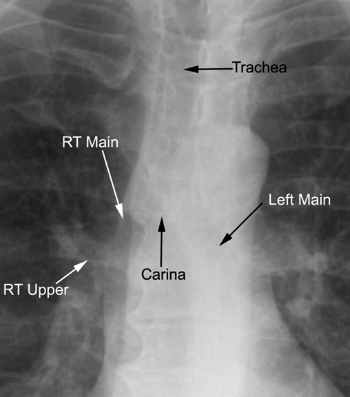 Try to identify the following