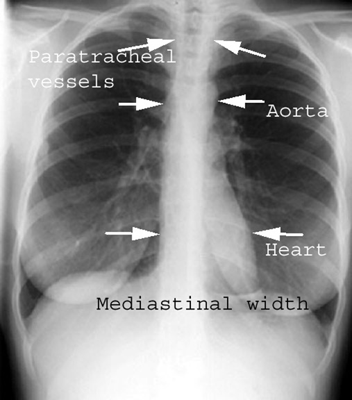 Try to identify the following