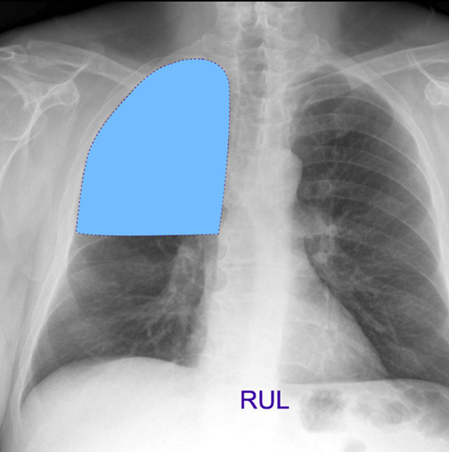 Try to identify the following