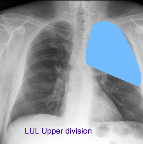 Try to identify the following