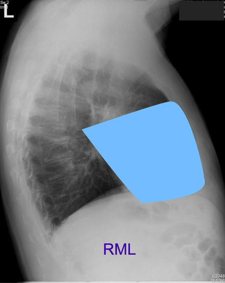 Thorax Radiologic Anatomy
