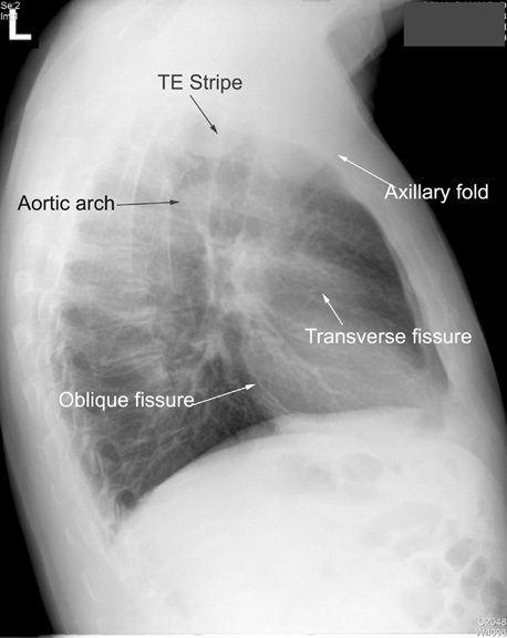 Try to identify the following