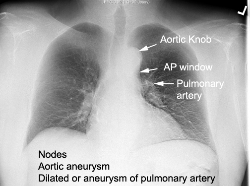 Try to identify the following