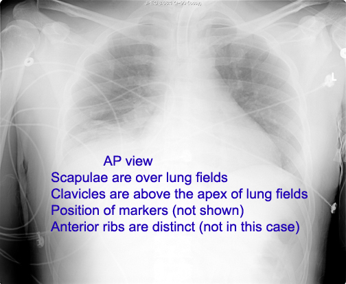 Try to identify the following