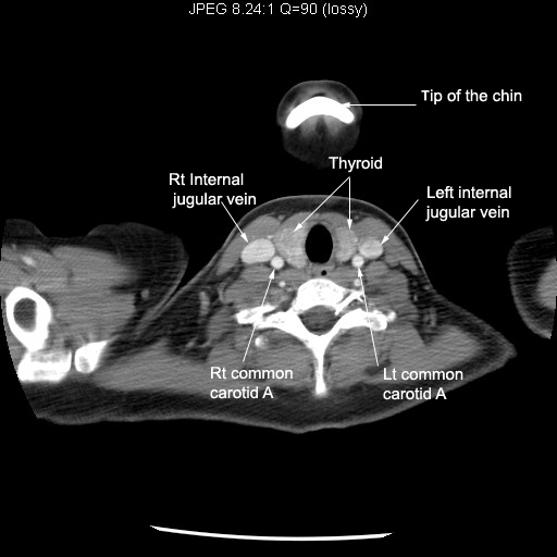 Identify the vascular structures. Click the image for labeling.